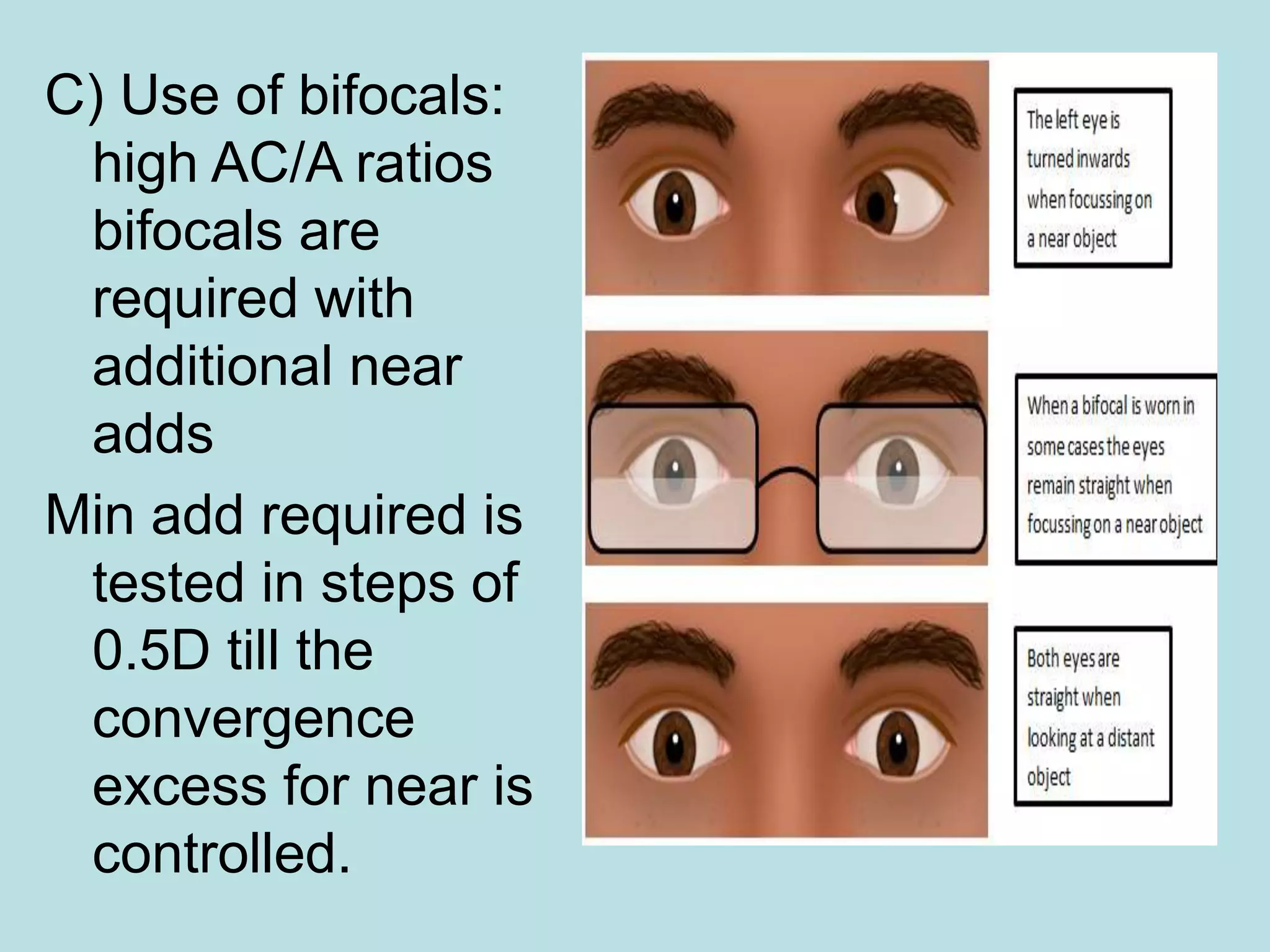 130335154-Non-Surgical-Management-of-squint.ppt