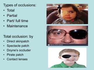 130335154-Non-Surgical-Management-of-squint.ppt