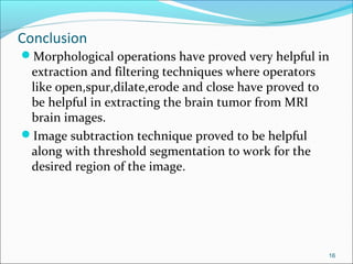 brain tumor detection by thresholding approach | PPT | Free Download