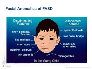Fetal Alcohol Spectrum Disorder/ 정고운 | PPTX