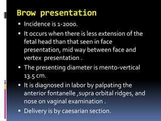 This is the relationship of the longitudinal axis of the fetus to ...