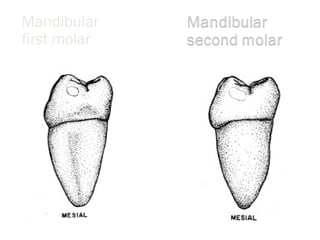 Difference-Between-Mandibular-First-Molar-and-Second-Molar | PPT