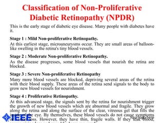 Classification of NPDR.ppt