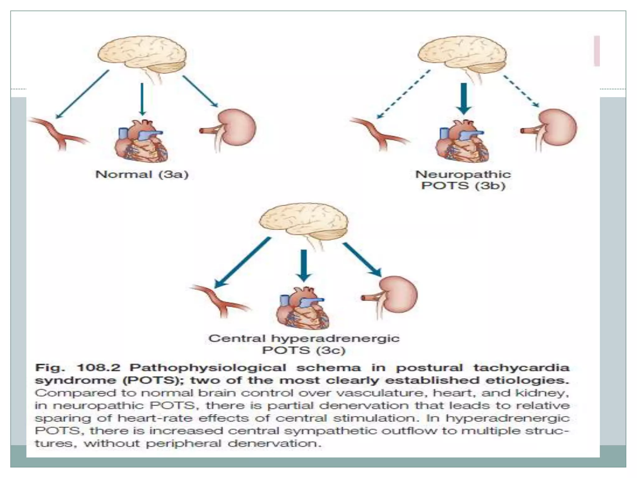 autonomic dysfunction and itz bedside tests | PPTX