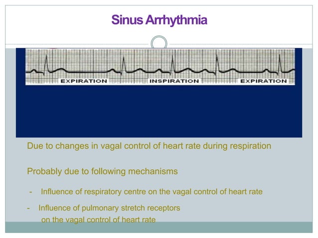 autonomic dysfunction and itz bedside tests | PPTX