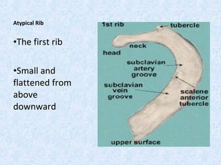 thoracic wall | PPT | Death, Injury, or Military Conflict | Sensitive ...