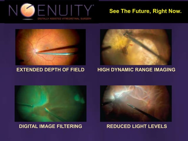 RETINA COMPANY SHOWCASE - TrueVision Systems | PPT