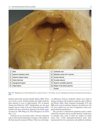 The Human Brainstem Anatomy and Pathology Schröder | PDF