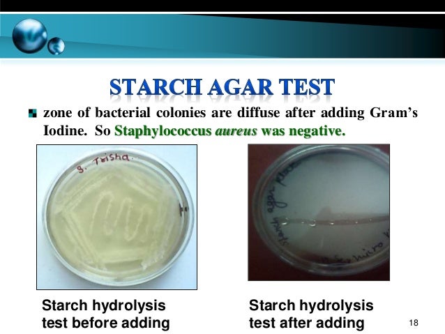 Gram negative bacteria in gelatin hydrolysis test - evolutionvere