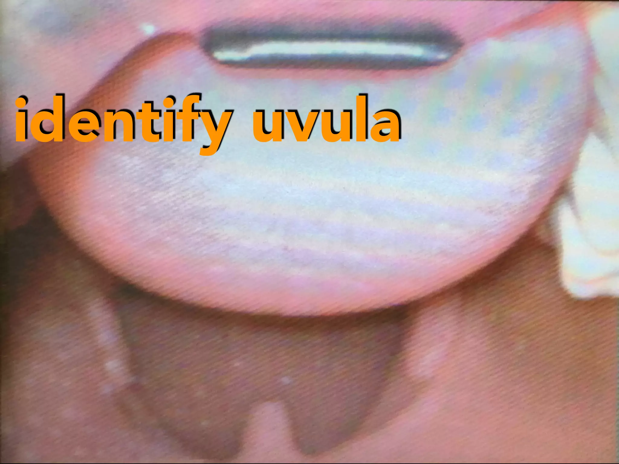 Leisurely Laryngoscopy | PDF