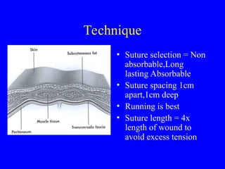 Ventral hernia repairs and surgery complications | PPT