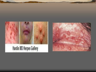 Materi Penyuluhan Seks bebas dan IMS.ppt