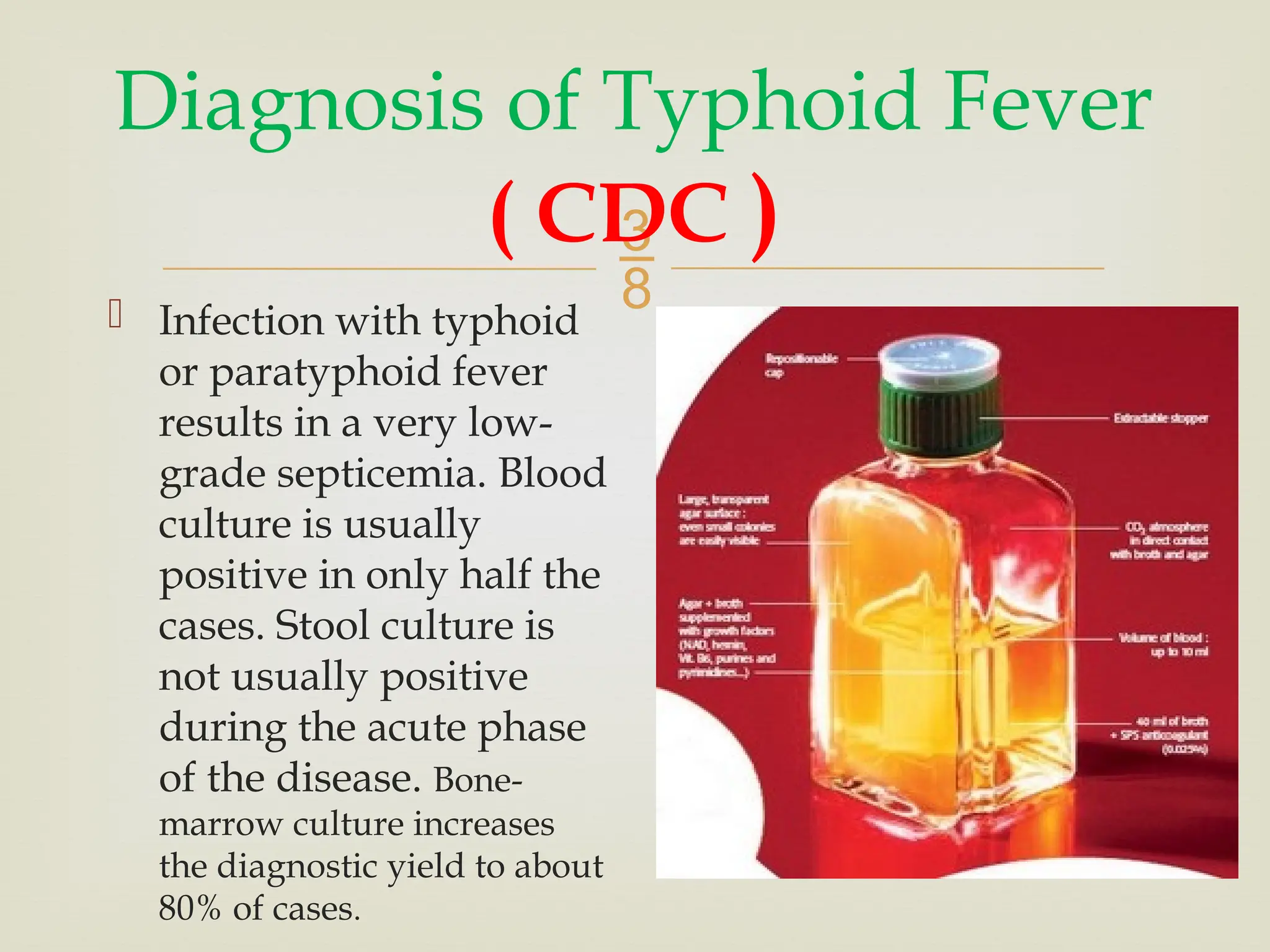 13 TEMPLATE SAMPLE OF TYPHOID FEVER.pptx