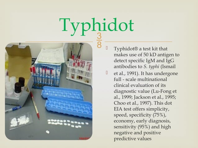 13 TEMPLATE SAMPLE OF TYPHOID FEVER.pptx