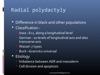 common congenital deformities of hand | PPT