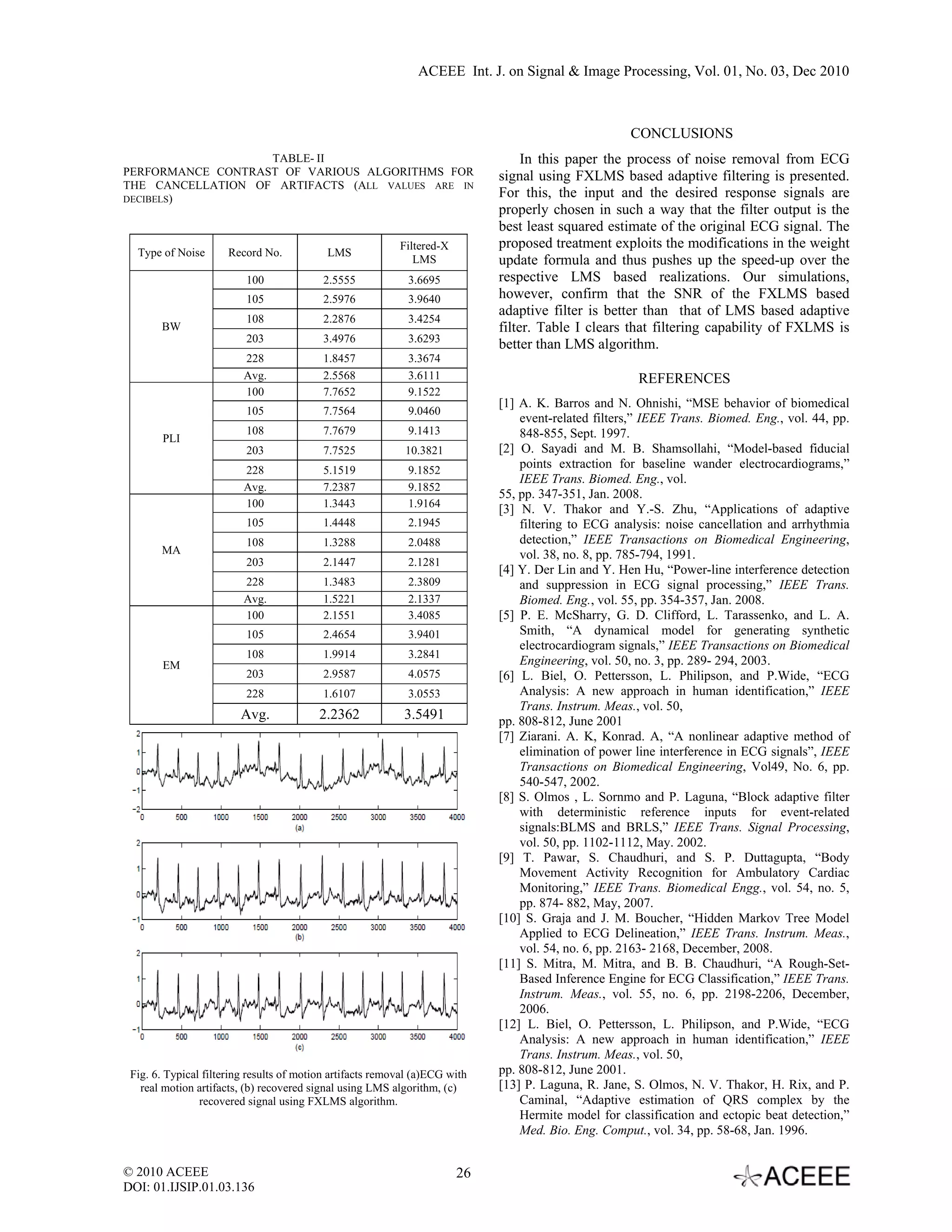 Filtering Electrocardiographic Signals Using Filtered X Lms Algorithm