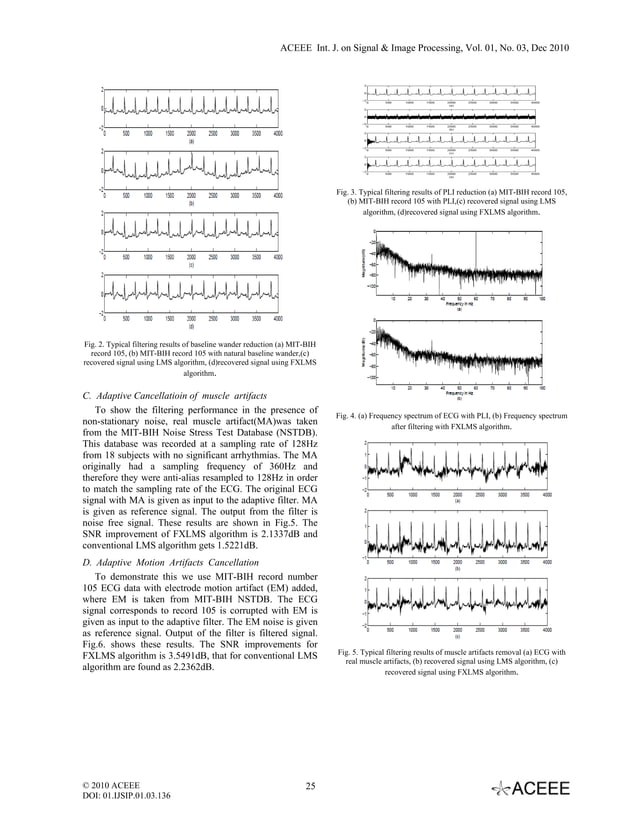 Filtering Electrocardiographic Signals Using Filtered X Lms Algorithm Pdf Digital Audio