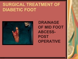1362564096 anatomy and spread of foot infections | PPT