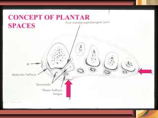 1362571268 anatomy and spread of foot infections | PPT
