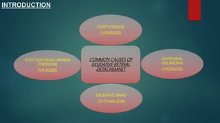A Case Of Bilateral Exudative Retinal Detachment | PPTX