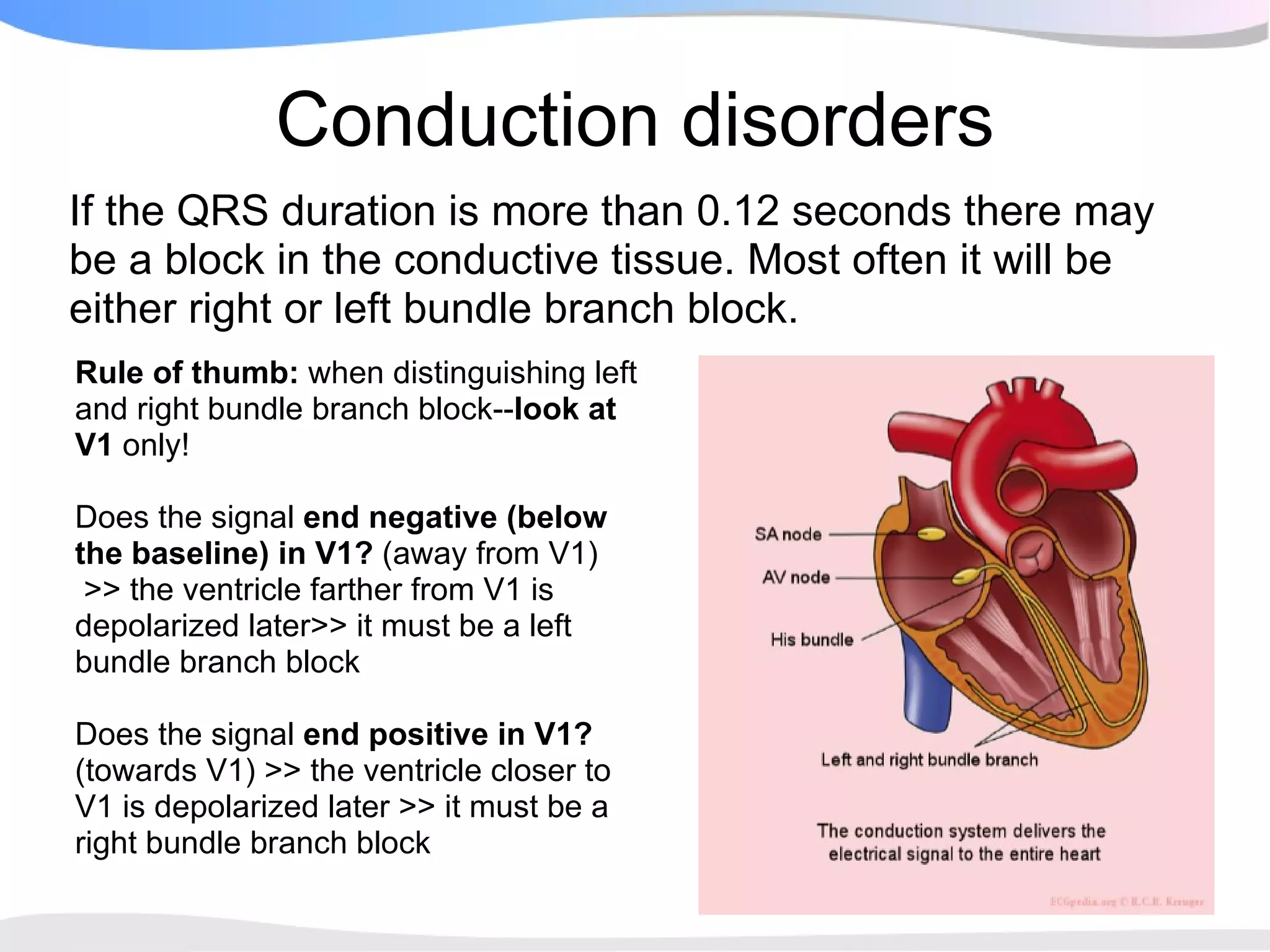 ECGpedia - ECG Presentation | PPT