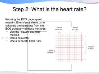 ECGpedia - ECG Presentation | PPT