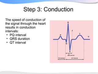ECGpedia - ECG Presentation | PPT