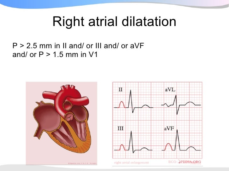 ECGpedia - ECG Presentation