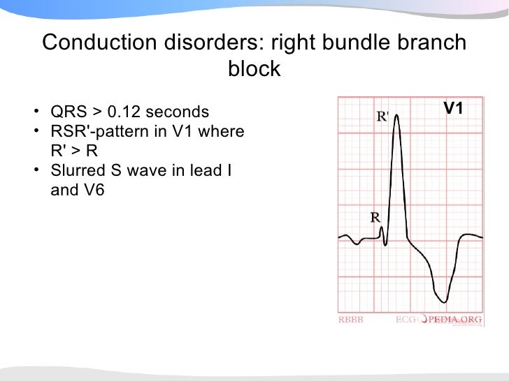 ECGpedia - ECG Presentation