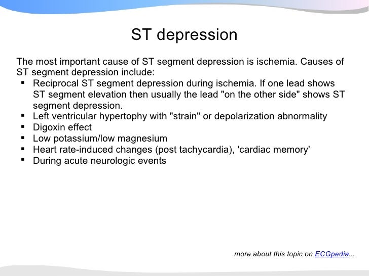 ECGpedia - ECG Presentation