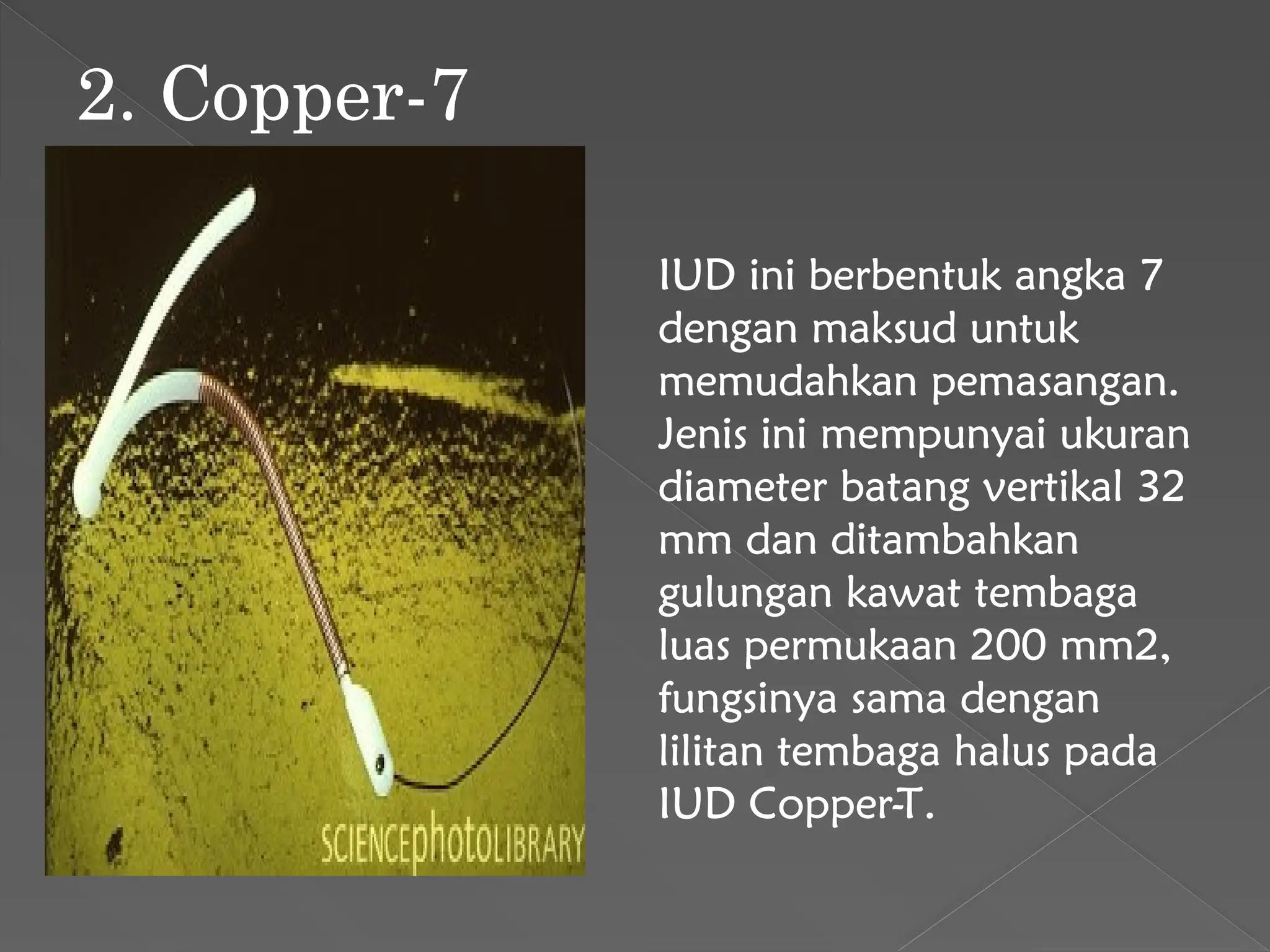 137345sdaaaaaadasdsadwd398-KB-IUD-ppt.pptx