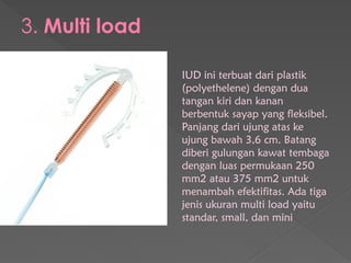 137345sdaaaaaadasdsadwd398-KB-IUD-ppt.pptx