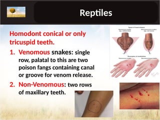 BITE MARKS IN FORENSIC ODONTOLOGY AND INVESTIGATIONS | PPT