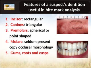 BITE MARKS IN FORENSIC ODONTOLOGY AND INVESTIGATIONS | PPT