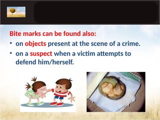 BITE MARKS IN FORENSIC ODONTOLOGY AND INVESTIGATIONS | PPT