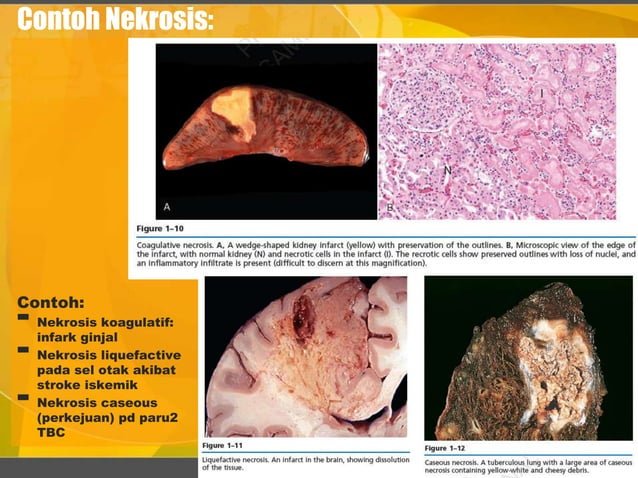 jejas adaptasi dan kematian sel presentasi.ppt