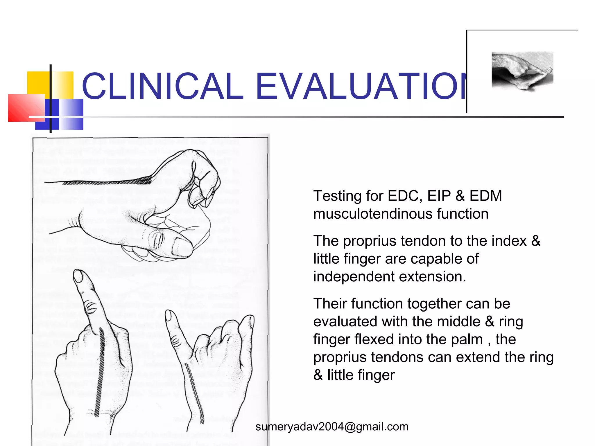 extensor tendons injury and deformity | PPT
