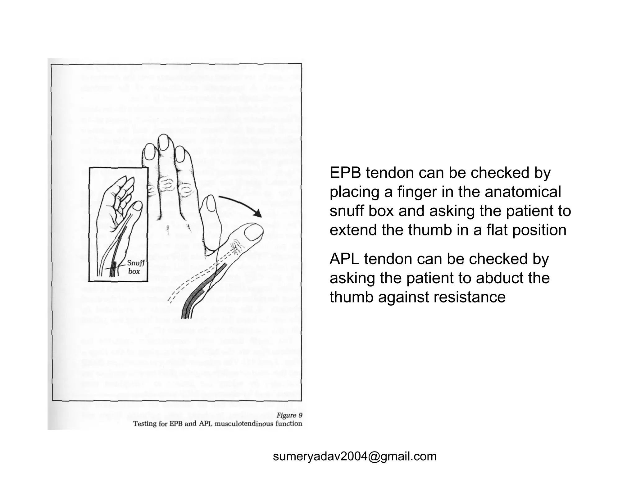 extensor tendons injury and deformity | PPT
