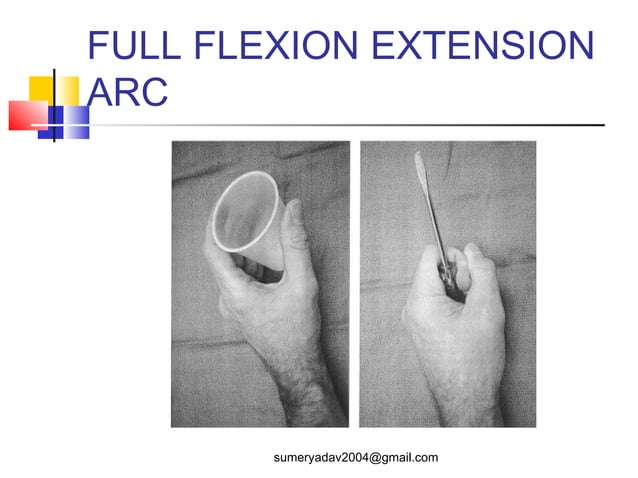 extensor tendons injury and deformity | PPT