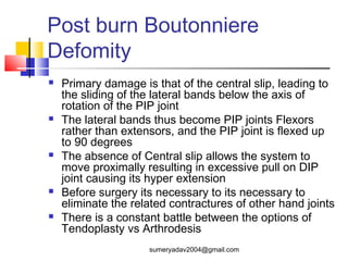 extensor tendons injury and deformity | PPT