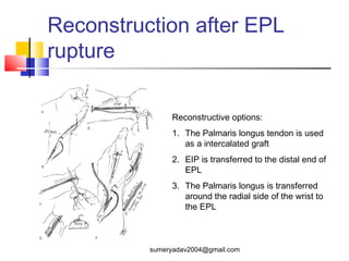 extensor tendons injury and deformity | PPT