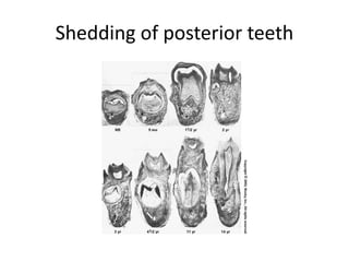 teeth shedding of the teeth dheedding.ppt