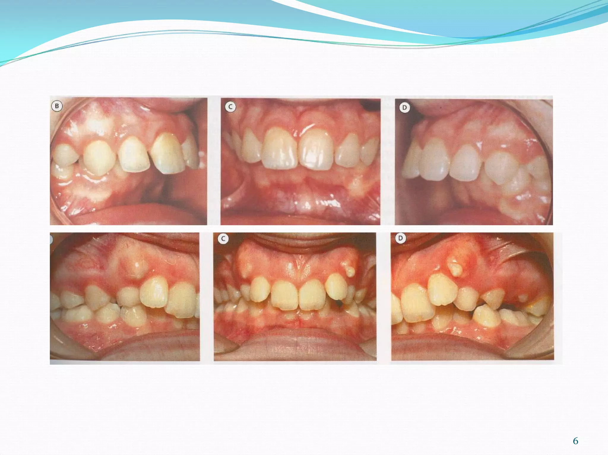 138324 diagnosis-an-orthodontic-case | PDF