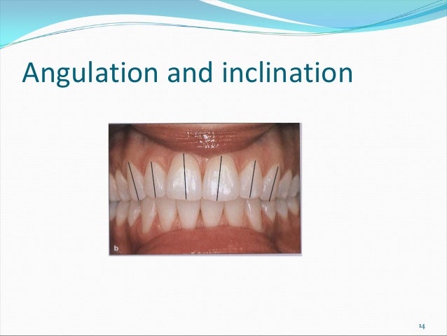 138324 diagnosis-an-orthodontic-case