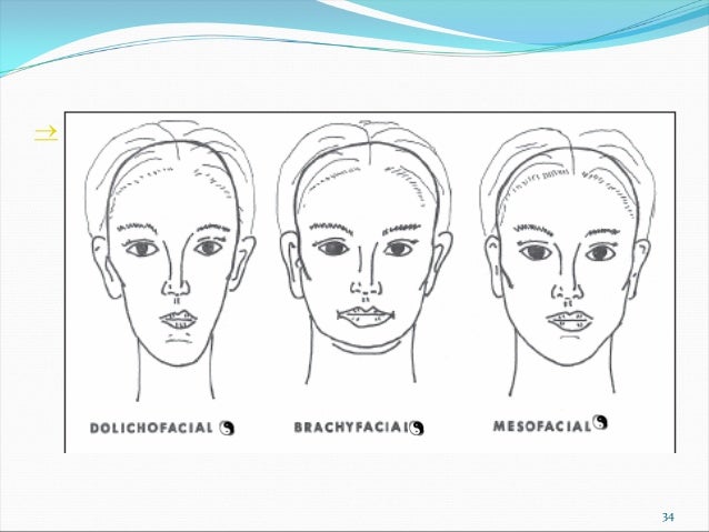 138324 diagnosis-an-orthodontic-case