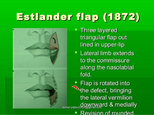 Lip Reconstruction
