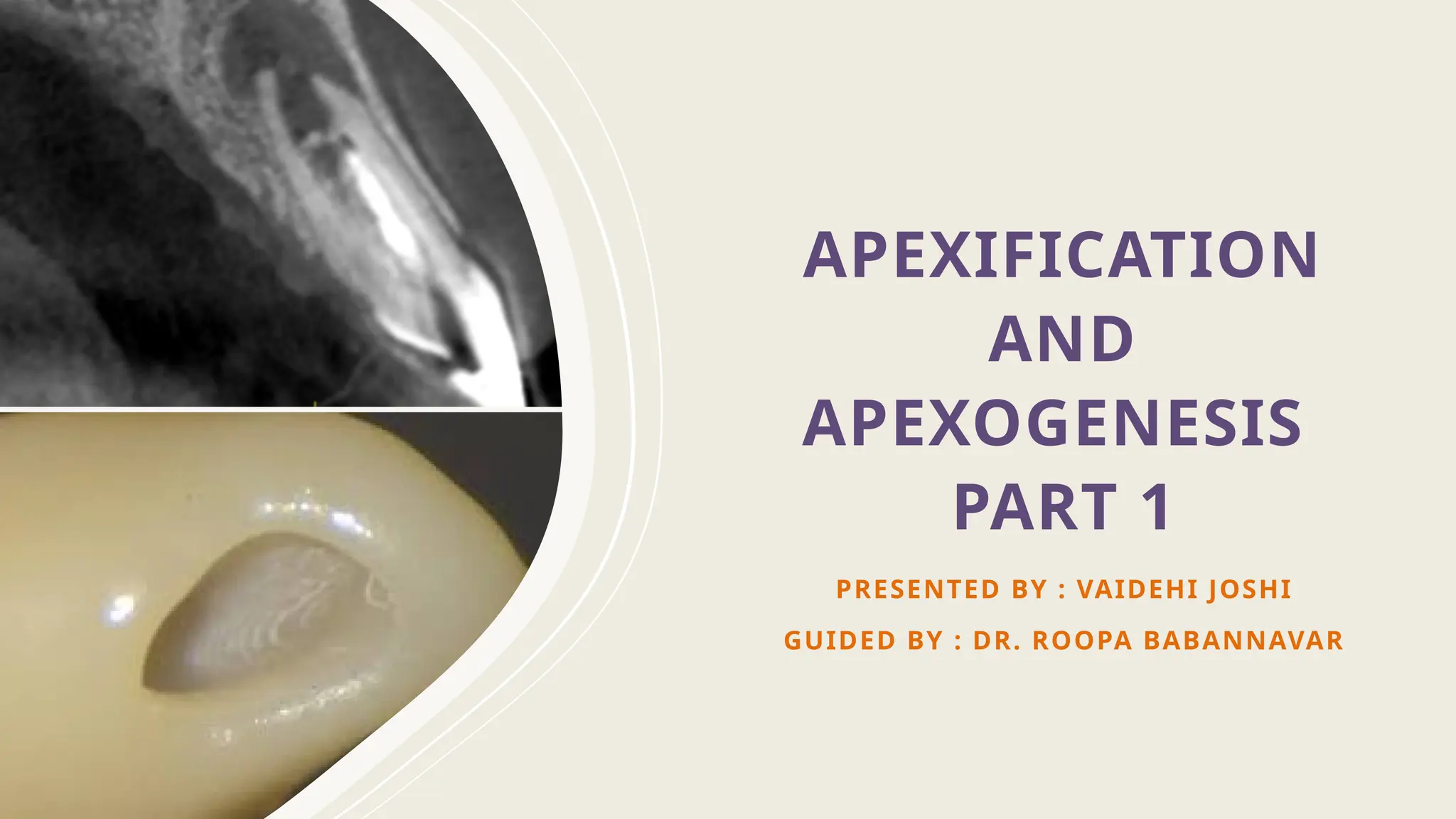 13 APEXIFICATION & APEXOGENESIS - Copy.pptx