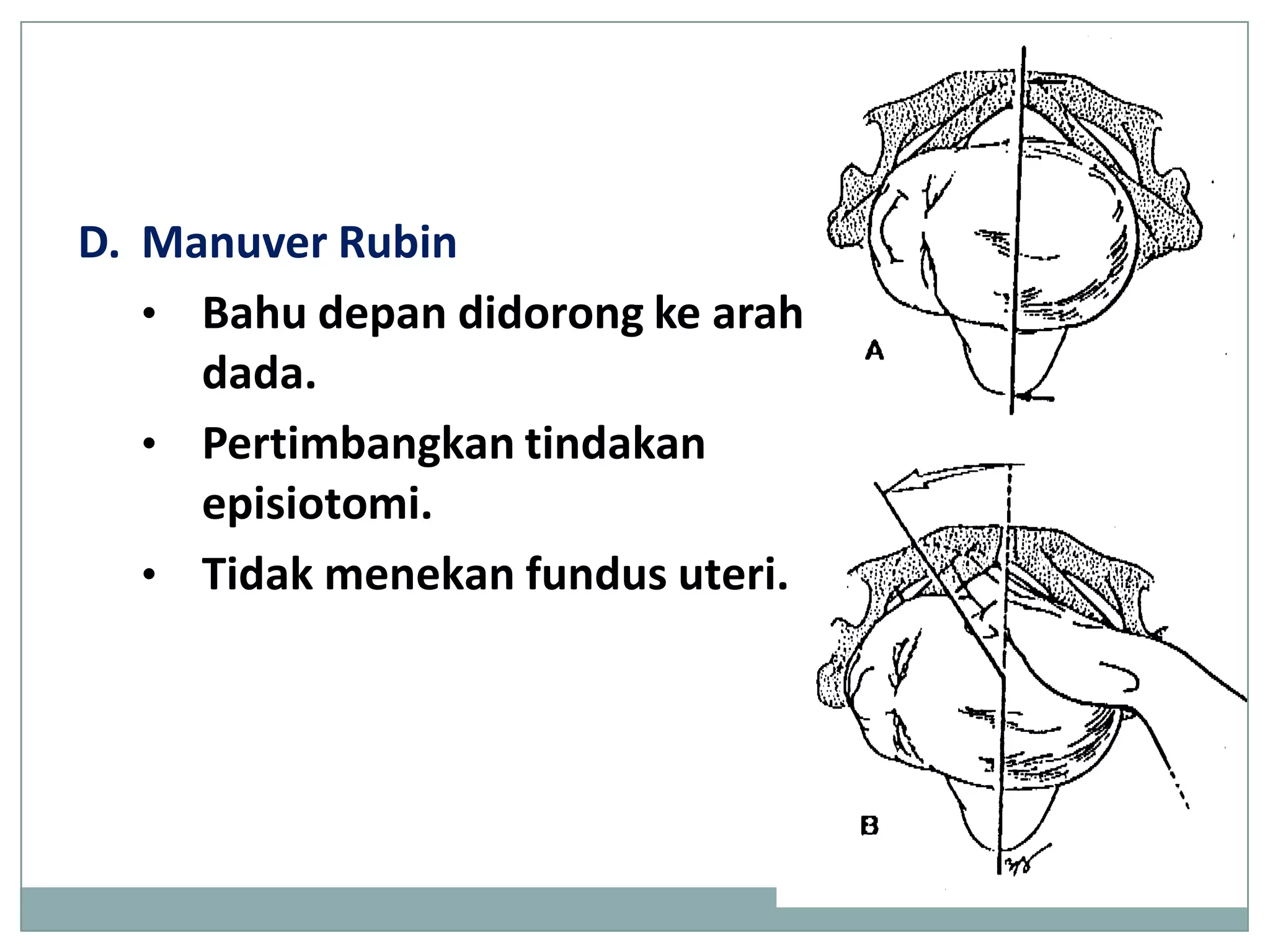 Distosia Bahu final | PDF