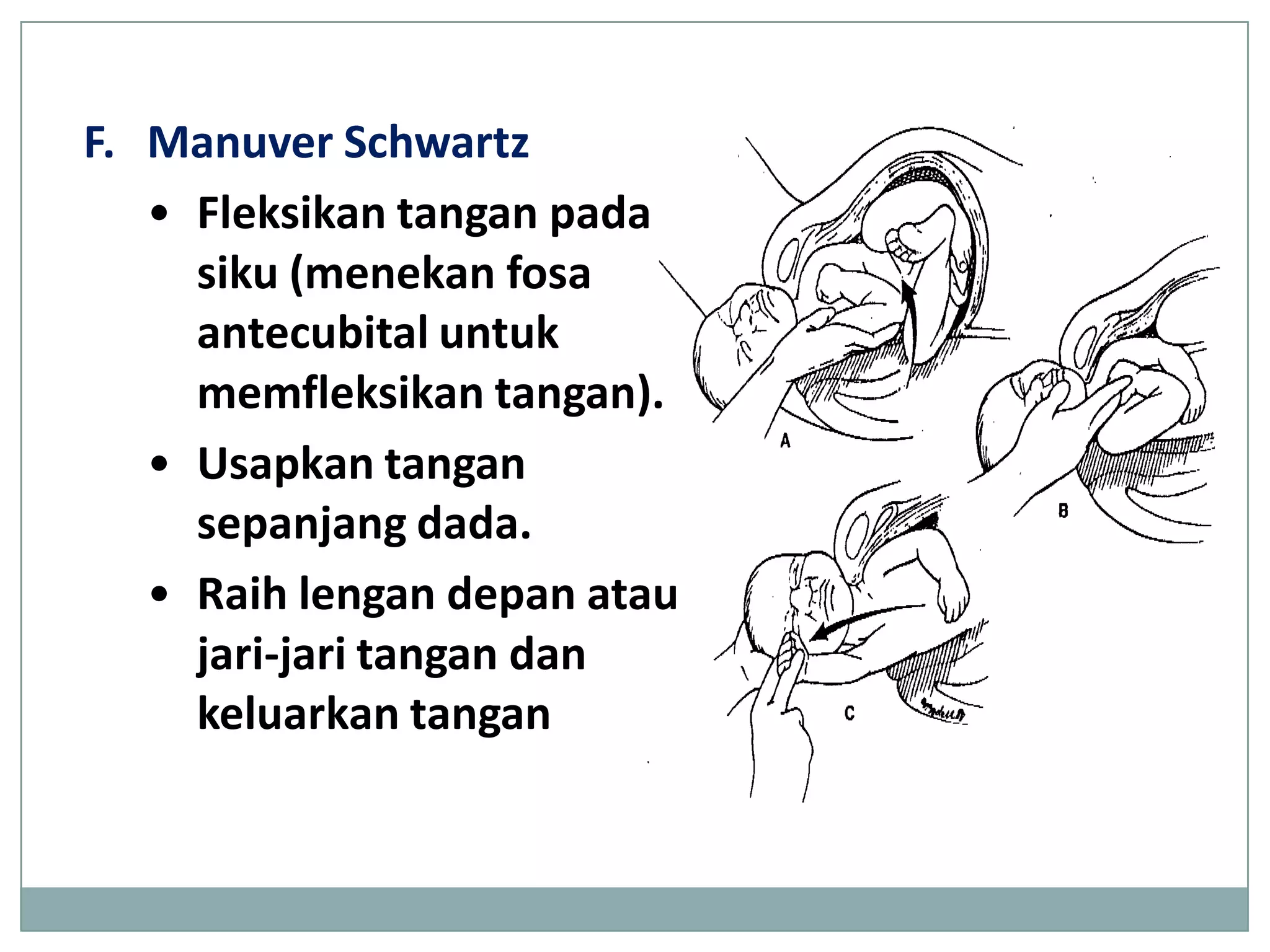 Distosia Bahu final | PDF