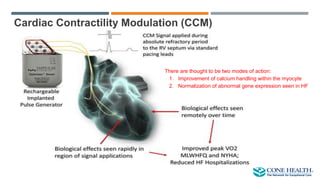 Devices in the Management of Chronic Heart Failure | PPTX